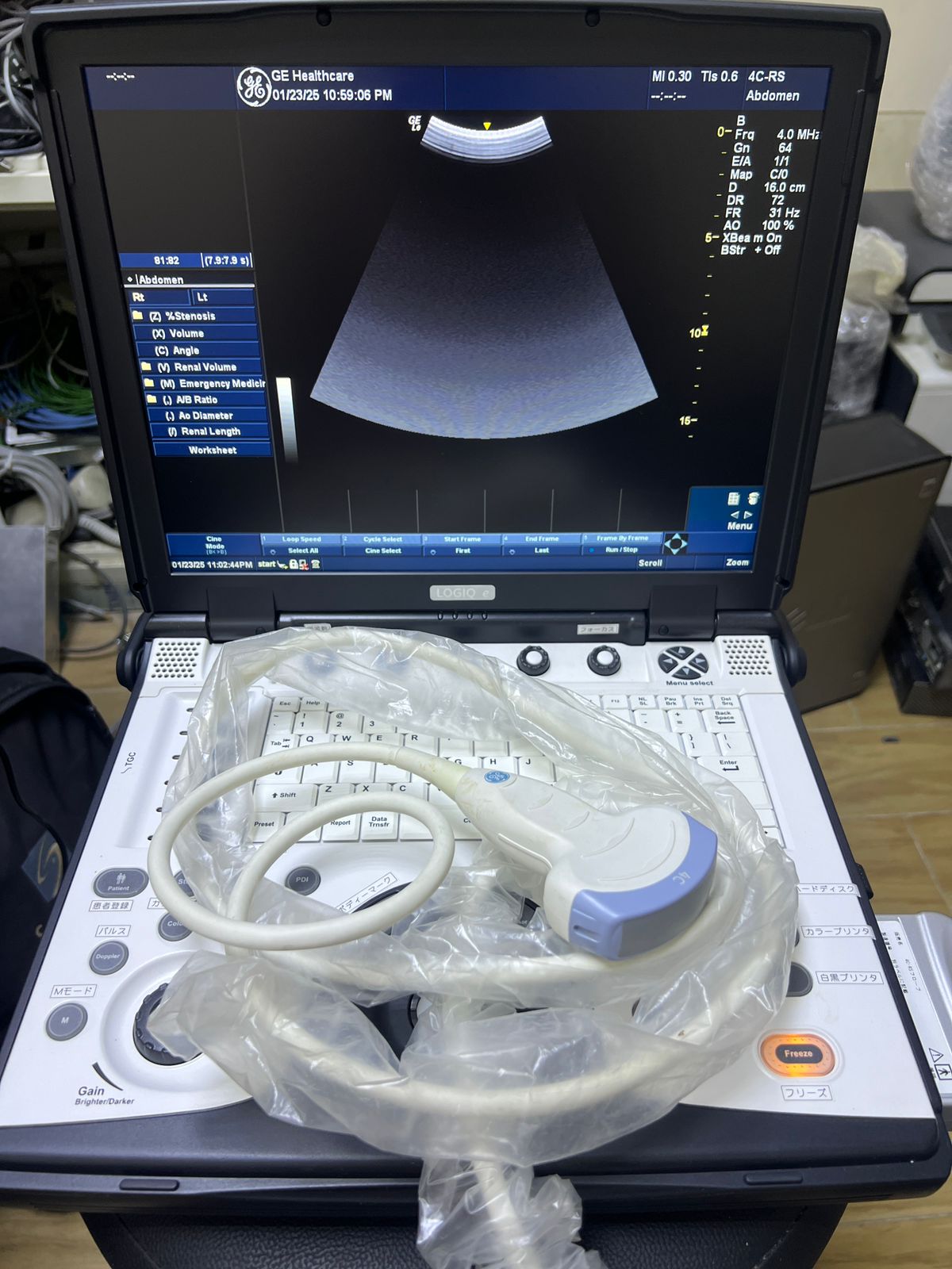GE Logiq e Portable Ultrasound - Alzaitoon - Specialize in medical ...